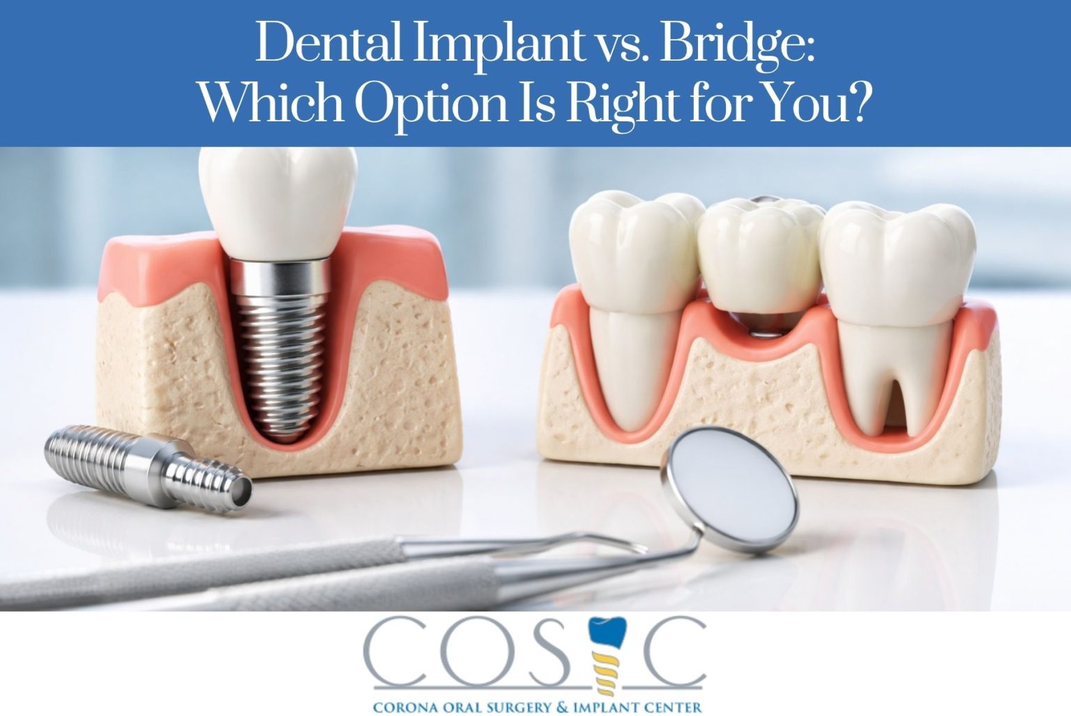 “Dental Implant vs. Bridge: Which Option Is Right for You? - Corona ...